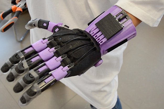 Toronto students offer a hand with the help of 3D printing - NOW Magazine