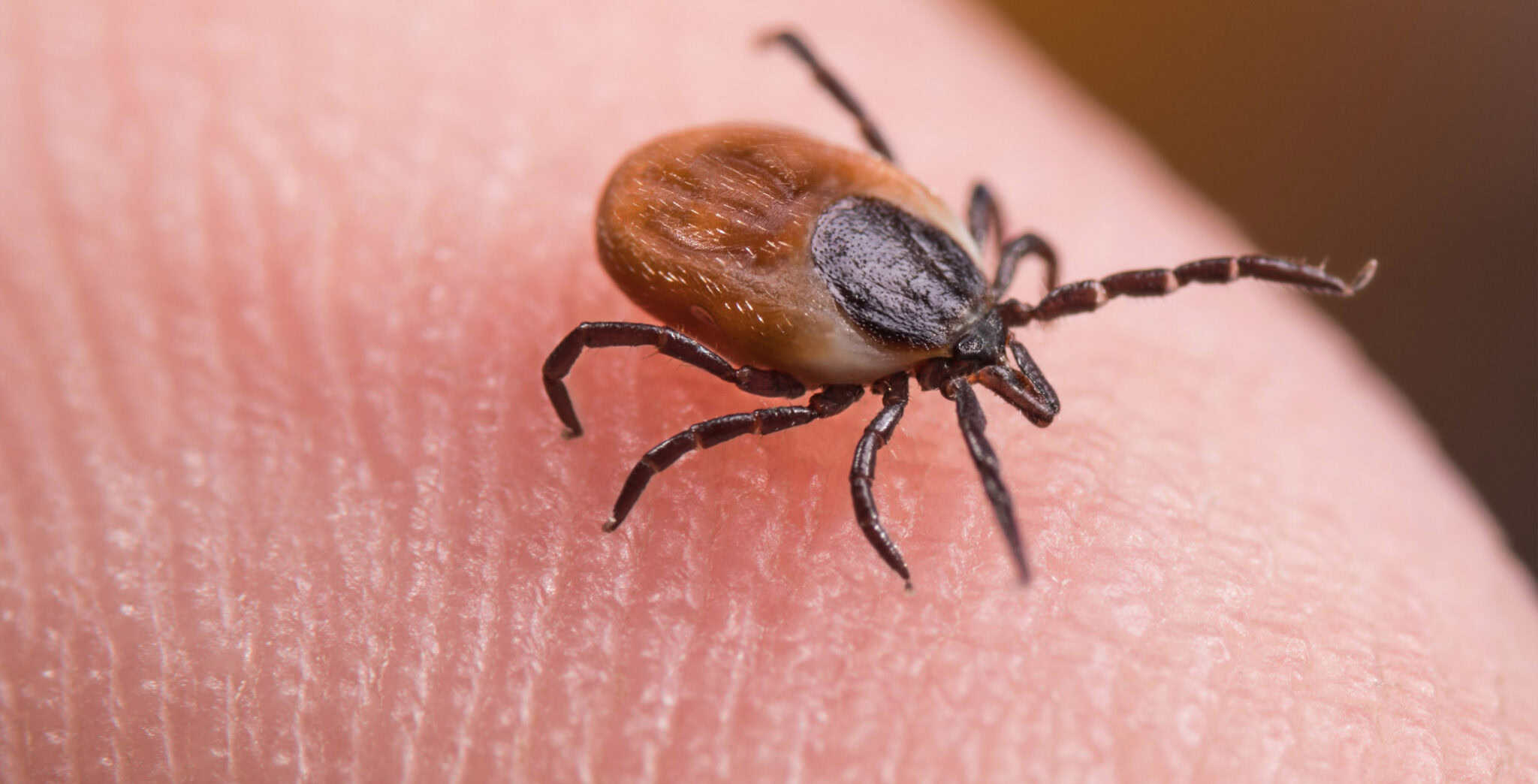 Ontarians are concerned about rising number of ticks, experts explain ...
